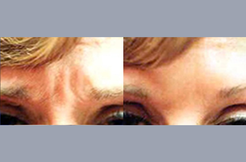 Photo Gallery - Mandal Plastic Surgery Center