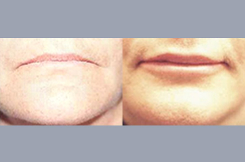 Photo Gallery - Mandal Plastic Surgery Center